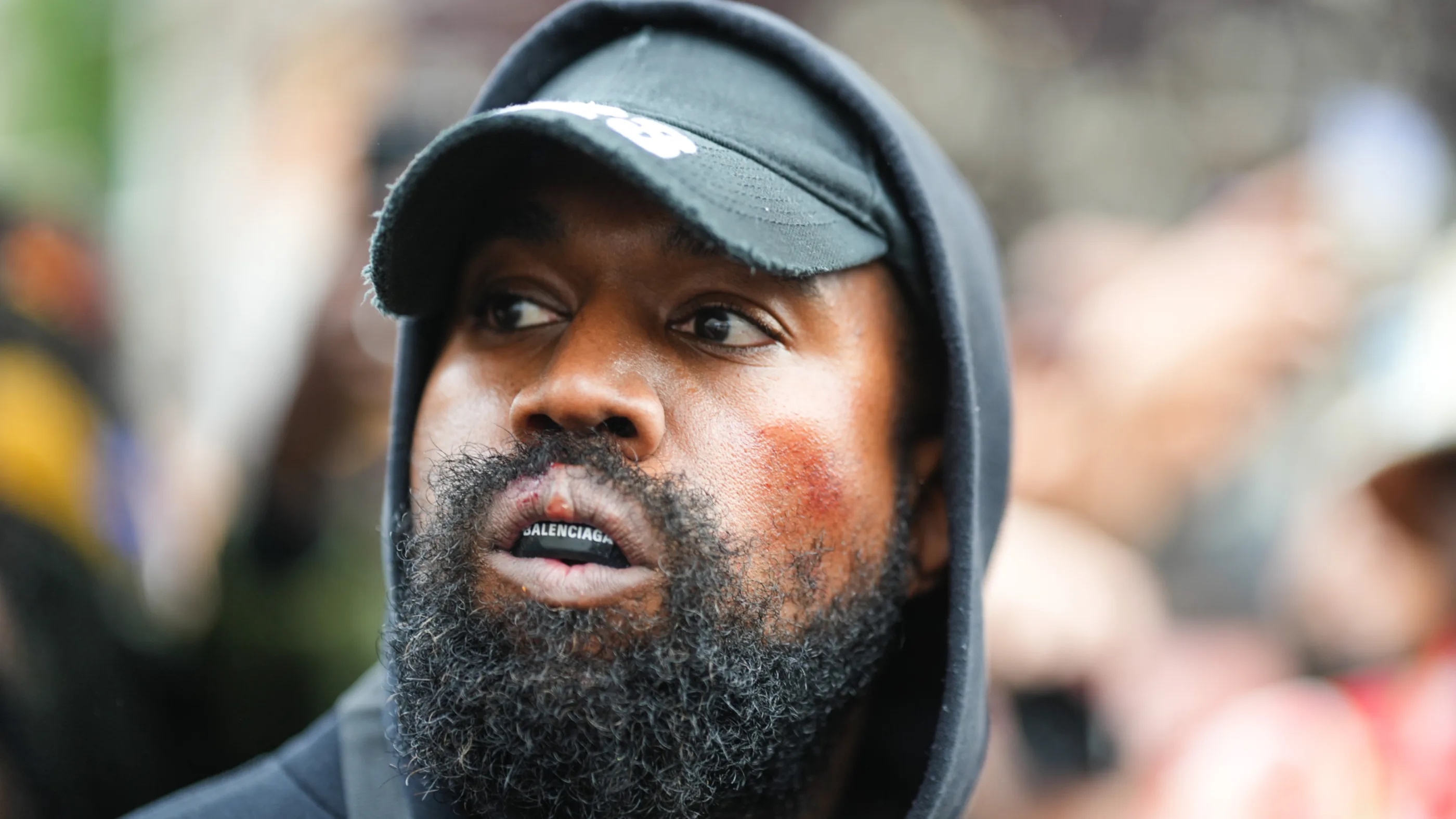 adidas 與 Ye 合作關係決裂後，下一步雙方究竟該何去何從？讓我們與法律顧問重新審視這場世紀交易 | Complex